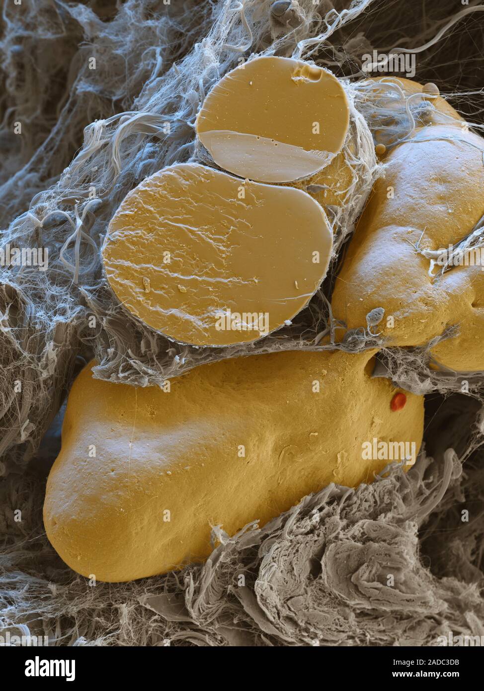 Fat cells. Coloured scanning electron micrograph (SEM) of a freeze ...