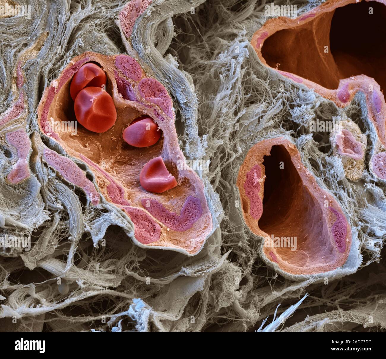Capillaries and red blood cells. Coloured scanning electron micrograph ...