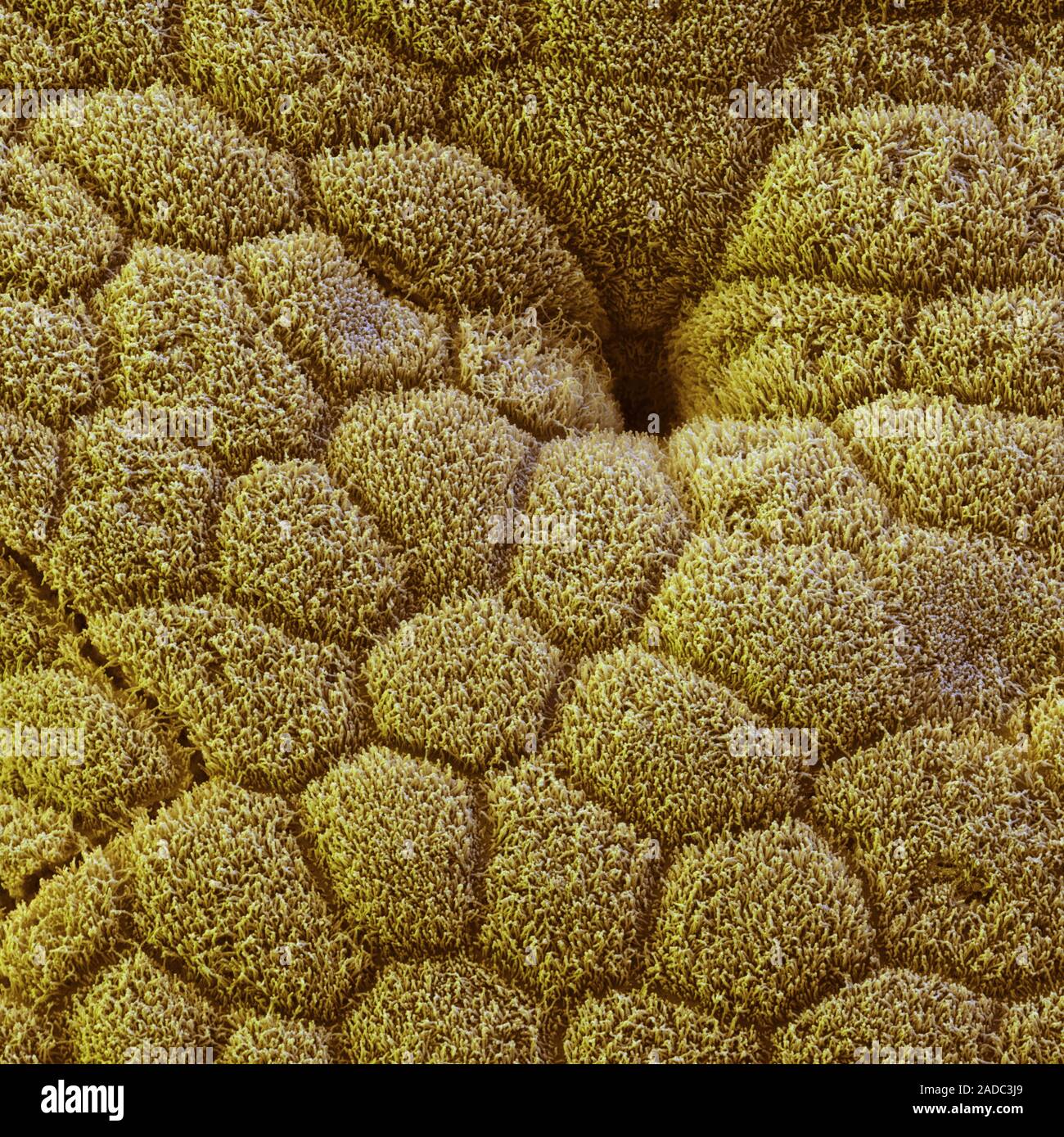 Gallbladder Epithelial Cells Coloured Scanning Electron Micrograph Sem Of Epithelial Cells