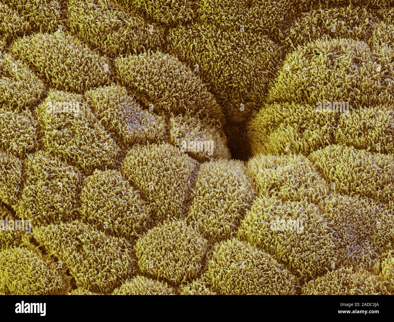 Gallbladder Epithelial Cells Coloured Scanning Electron Micrograph Sem Of Epithelial Cells