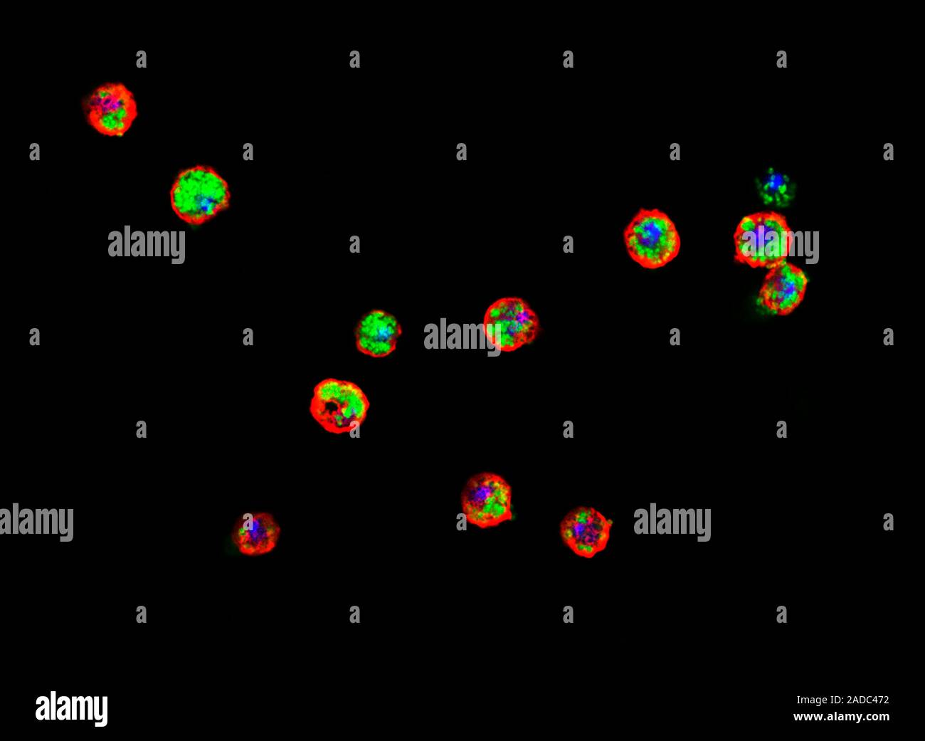 Fluorescence light micrograph of plasmatocytes from a fruit fly ...