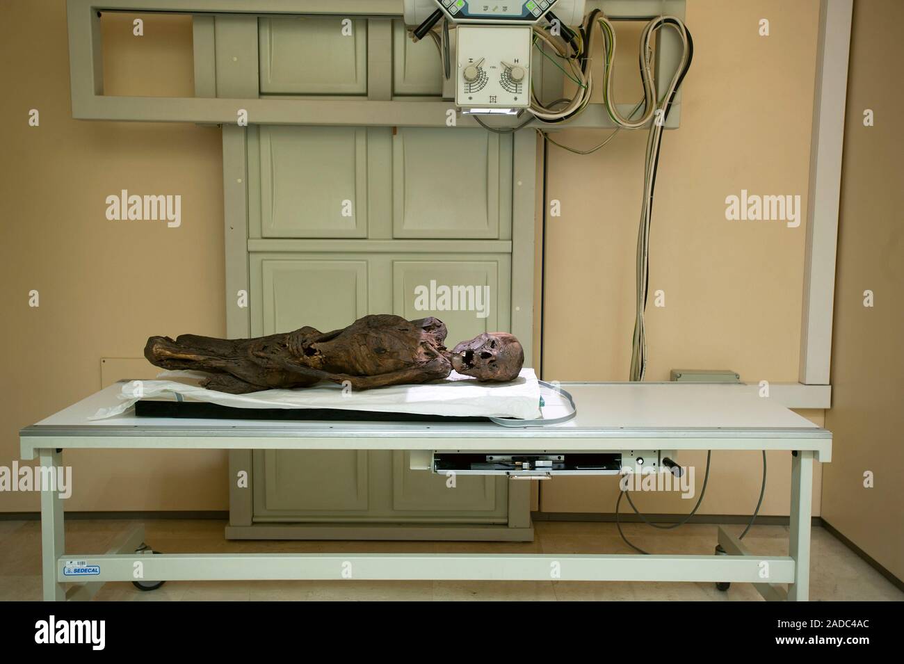 Peruvian mummy, X-ray research. This mummy of a young woman, being ...