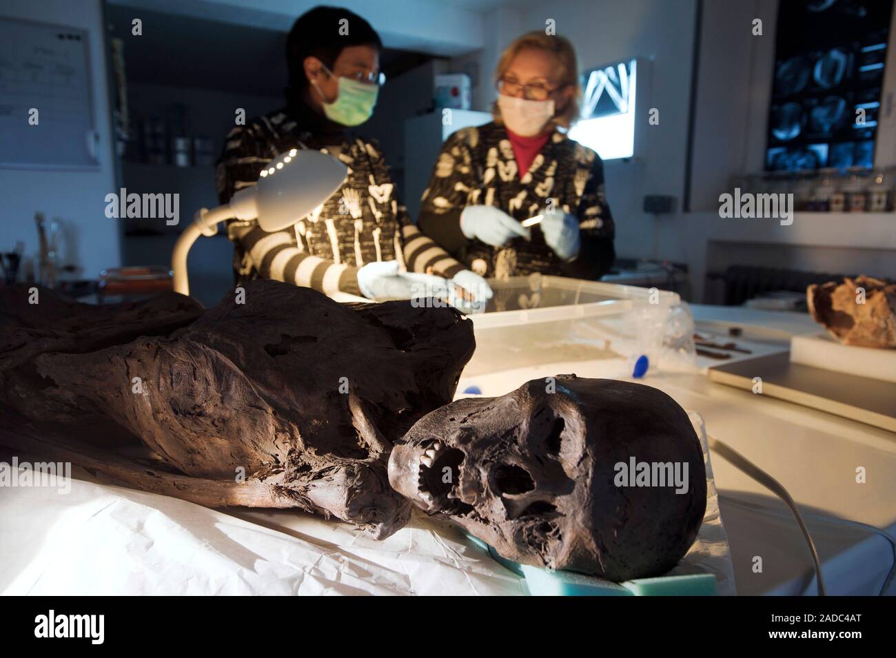 Peruvian mummy research. Researchers analysing specimens from the mummy ...