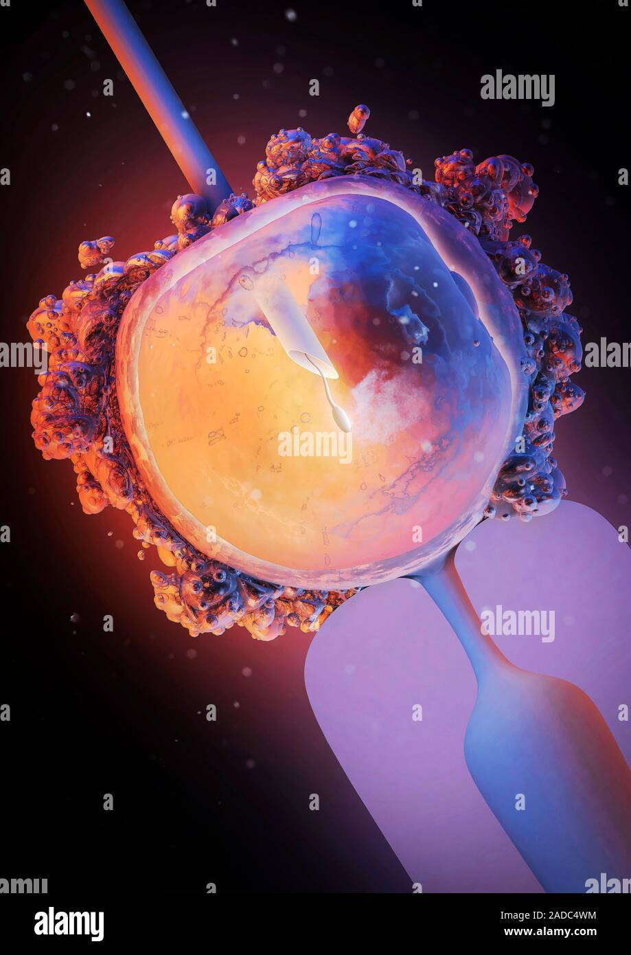 ICSI in vitro fertilisation. Computer illustration of a human egg cell ...
