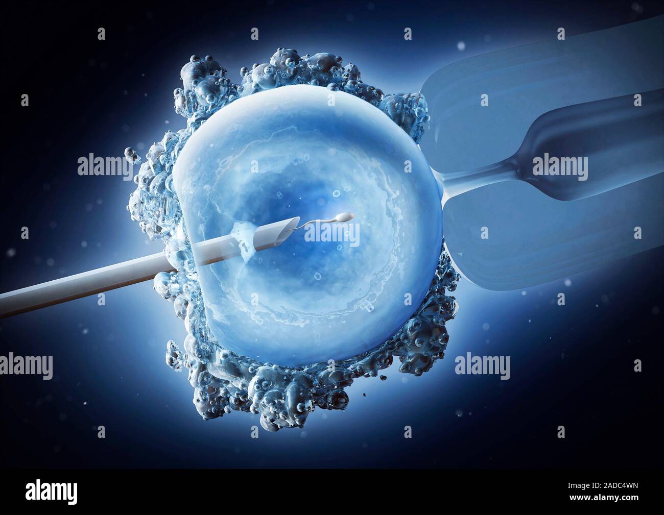 ICSI in vitro fertilisation. Computer illustration of a human egg cell ...