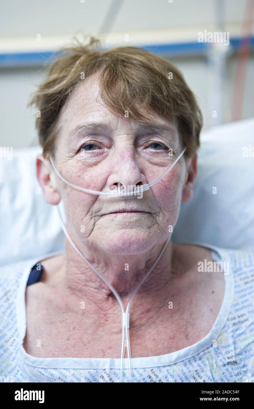 Patient with nasal cannula. Woman wearing a nasal cannula that is ...