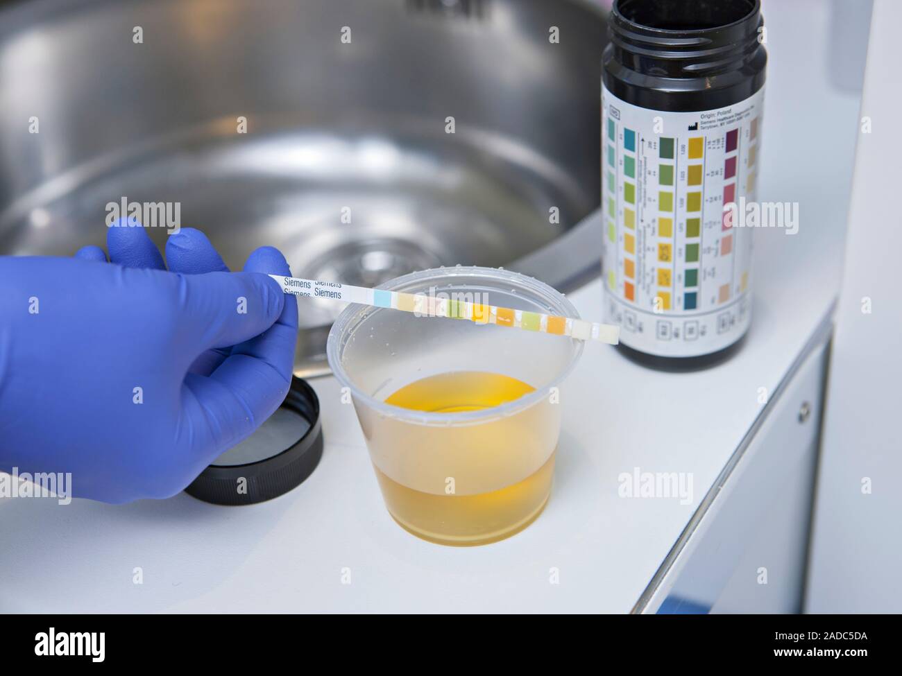 Urine self-testing kit. General practitioner (GP) using a kit for ...