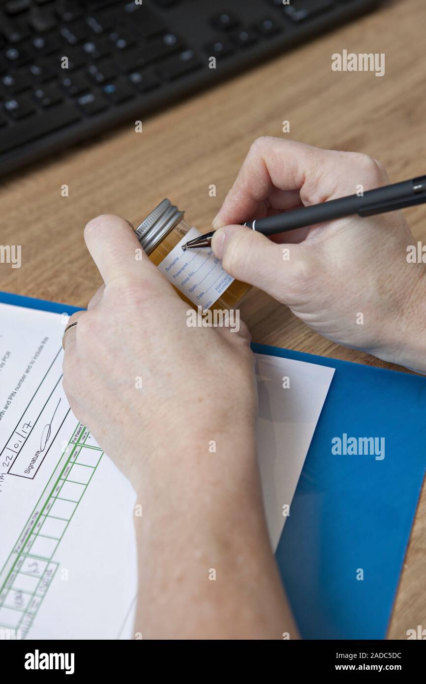 Urine sample labelling. General practitioner (GP) labelling a sample of ...