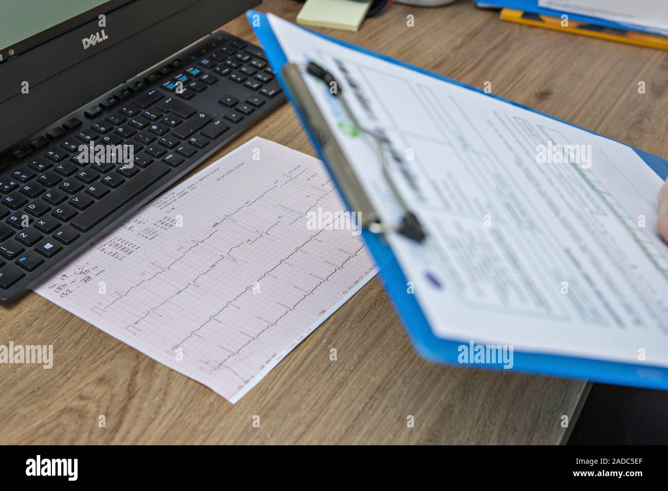 Electrocardiography test results and notes. Printed results and patient ...
