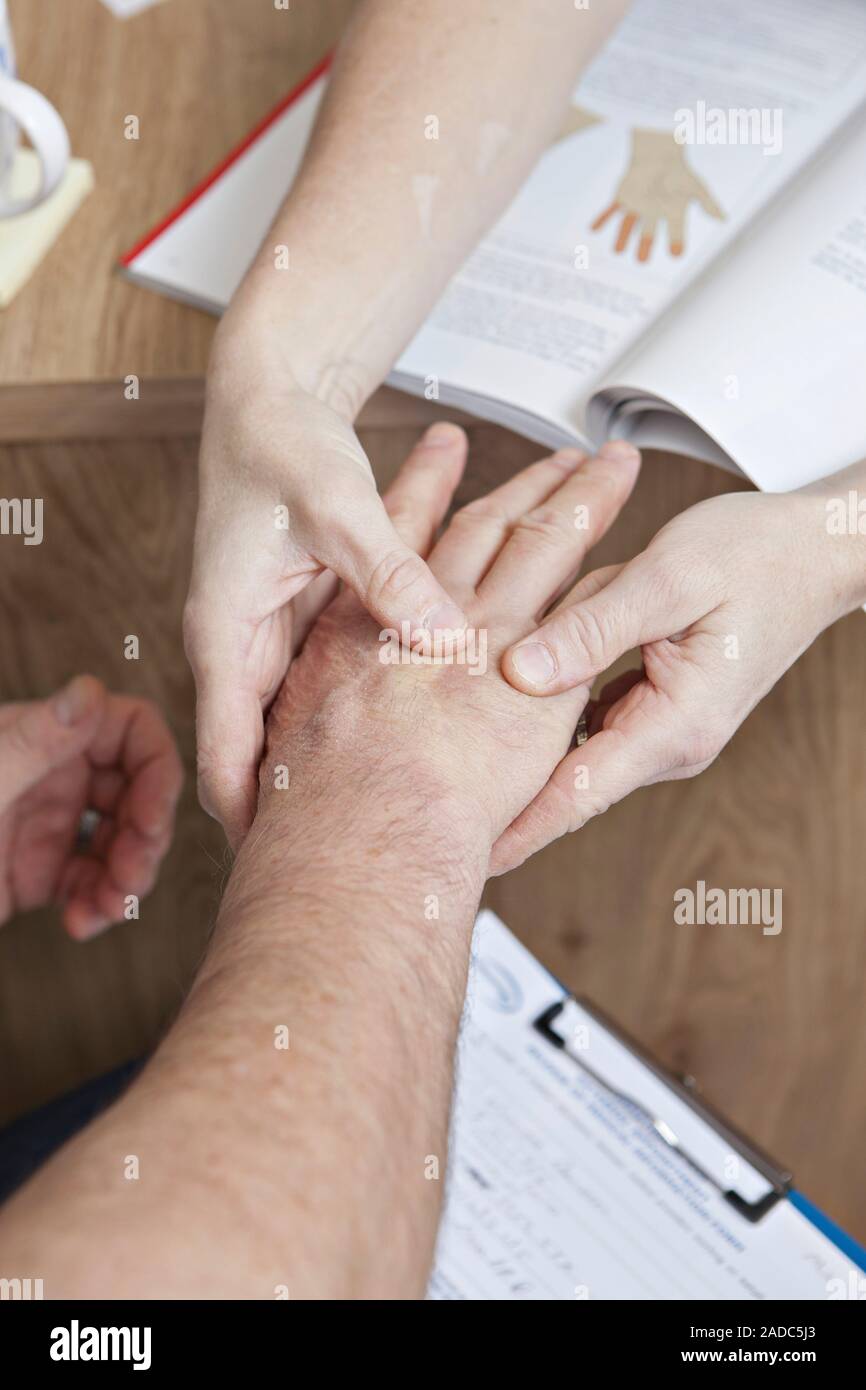 Carpal tunnel syndrome examination. Medical practitioner examining the ...