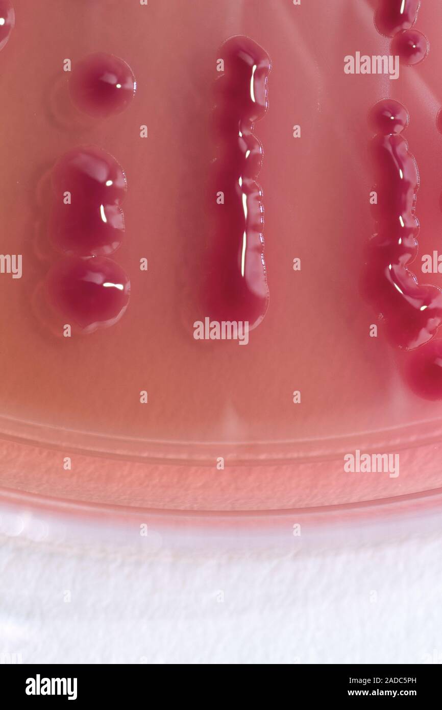 Acinetobacter baumannii bacterial culture. Close-up of a petri dish ... Acinetobacter baumannii bacterial culture. Close-up of a petri dish ...