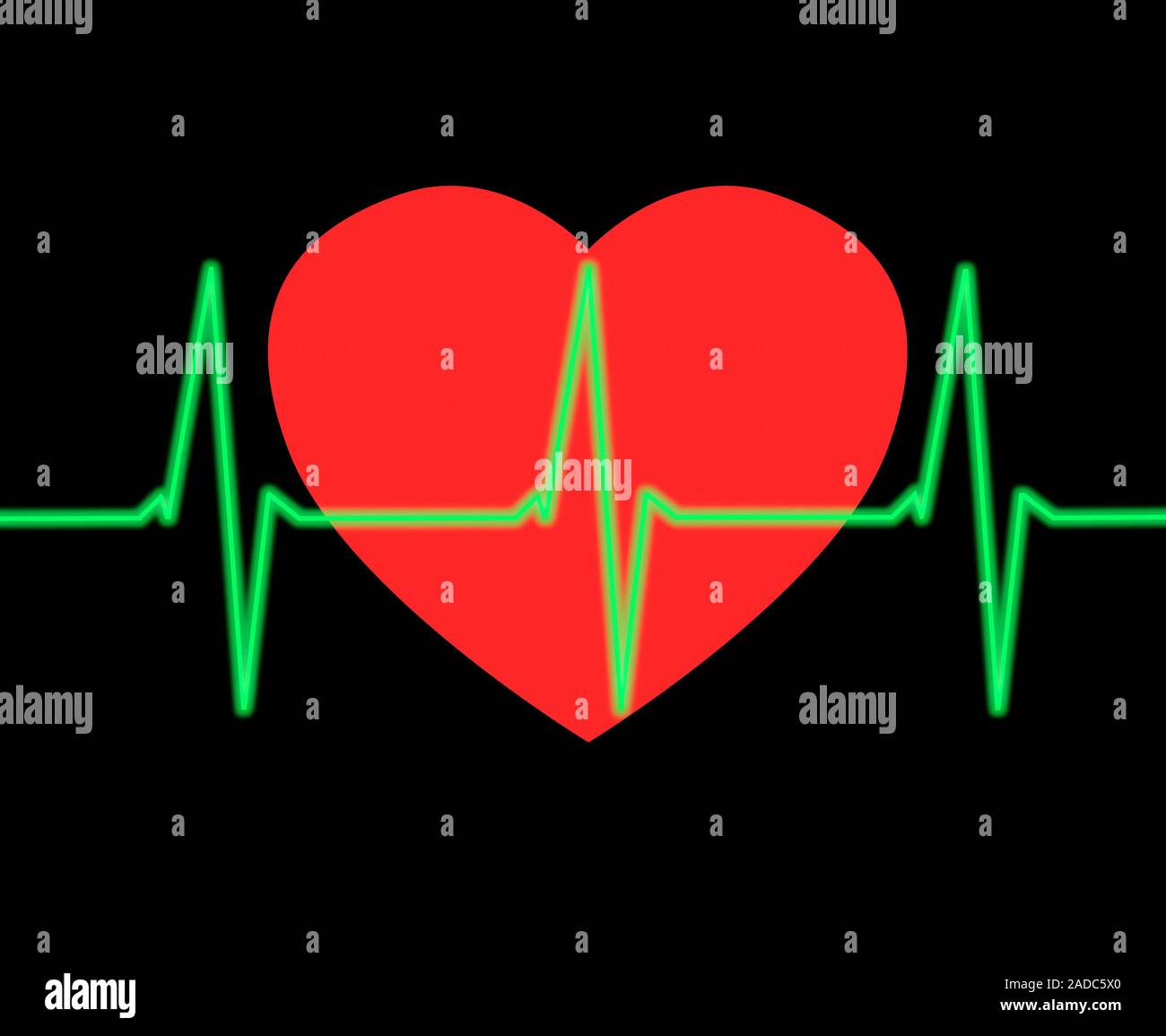 ECG heartbeat trace, conceptual image. Electrocardiogram trace (green ...