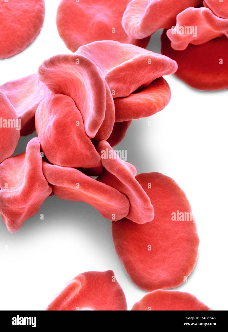Human red blood cells, coloured scanning electron micrograph (SEM) from ...