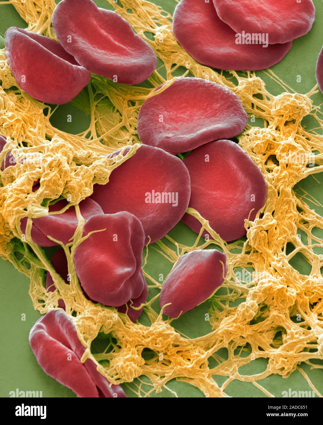 Red blood cells and platelets. Coloured scanning electon micrograph ...