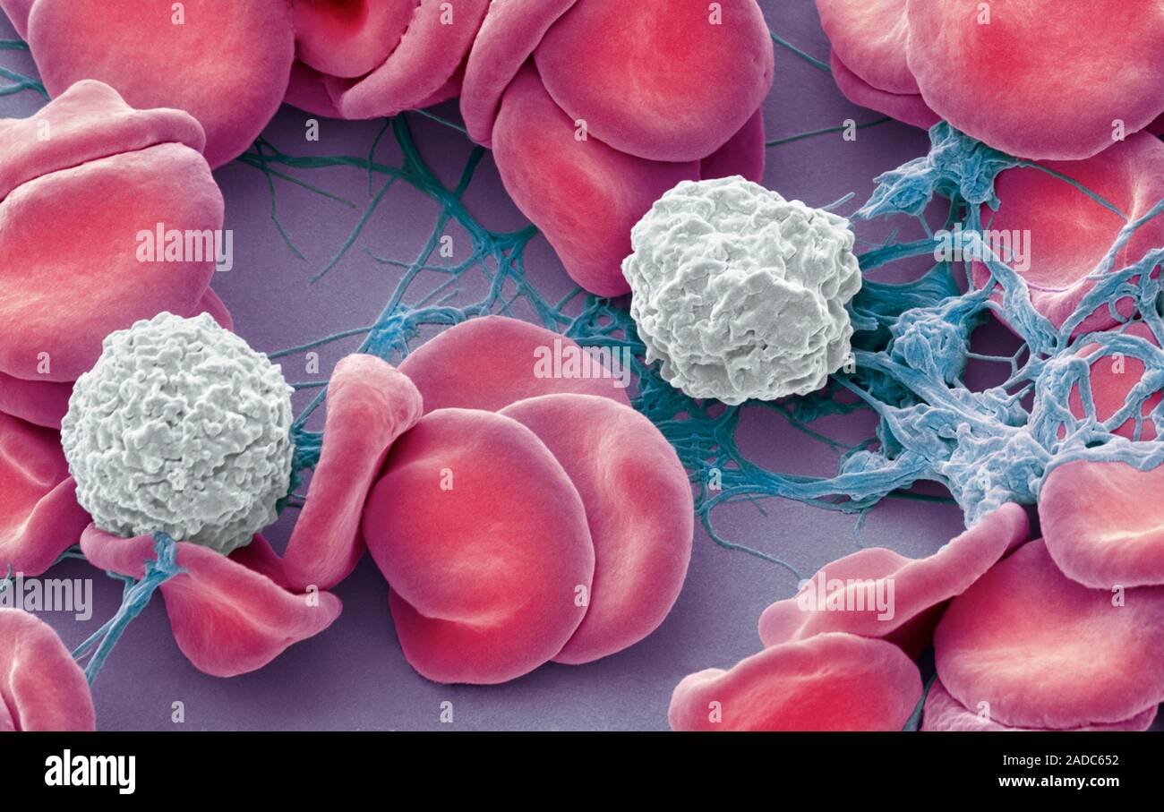 Human blood cells, Coloured scanning electron micrograph (SEM) of a ...