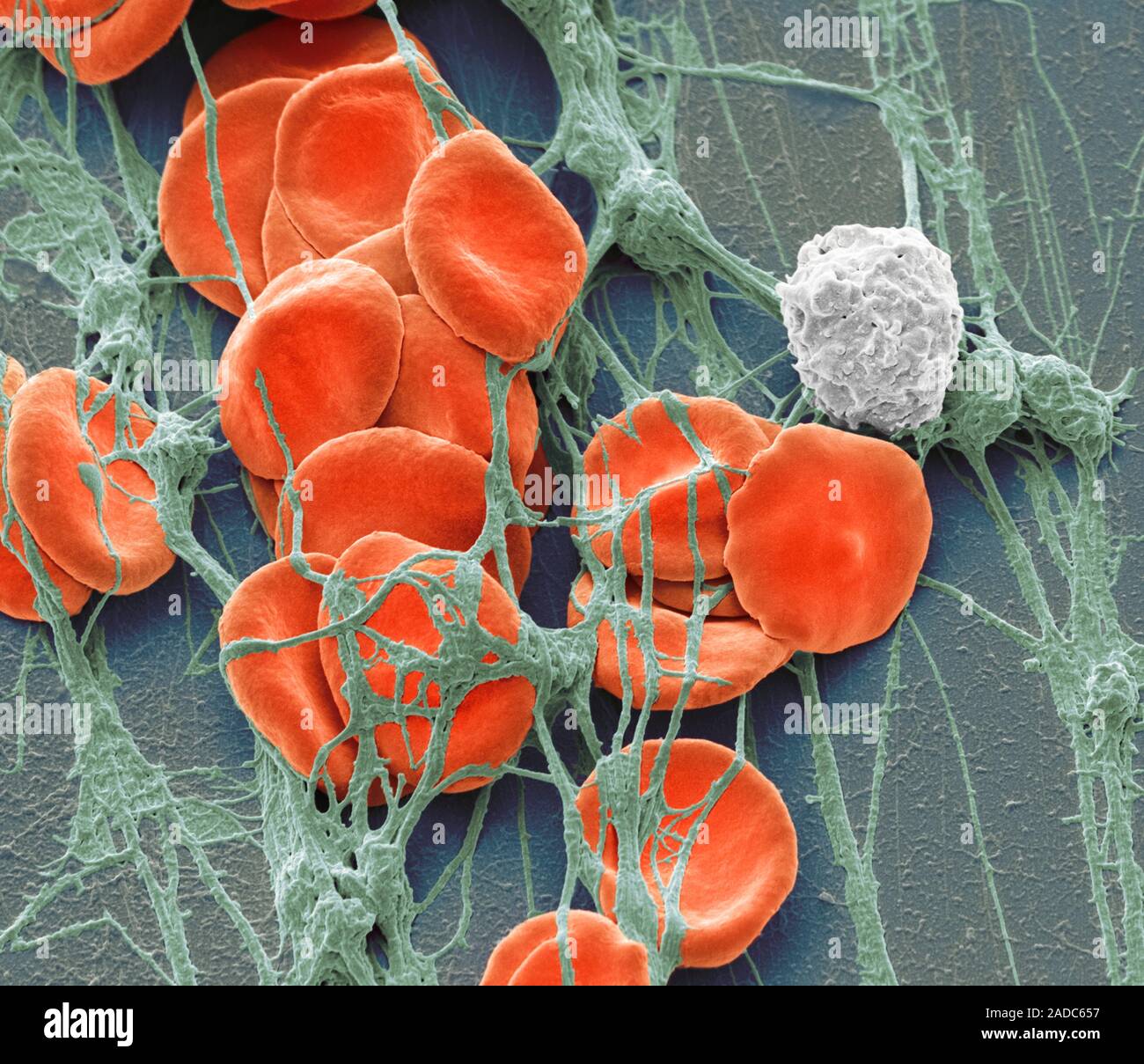 Human blood cells, Coloured scanning electron micrograph (SEM) of a ...