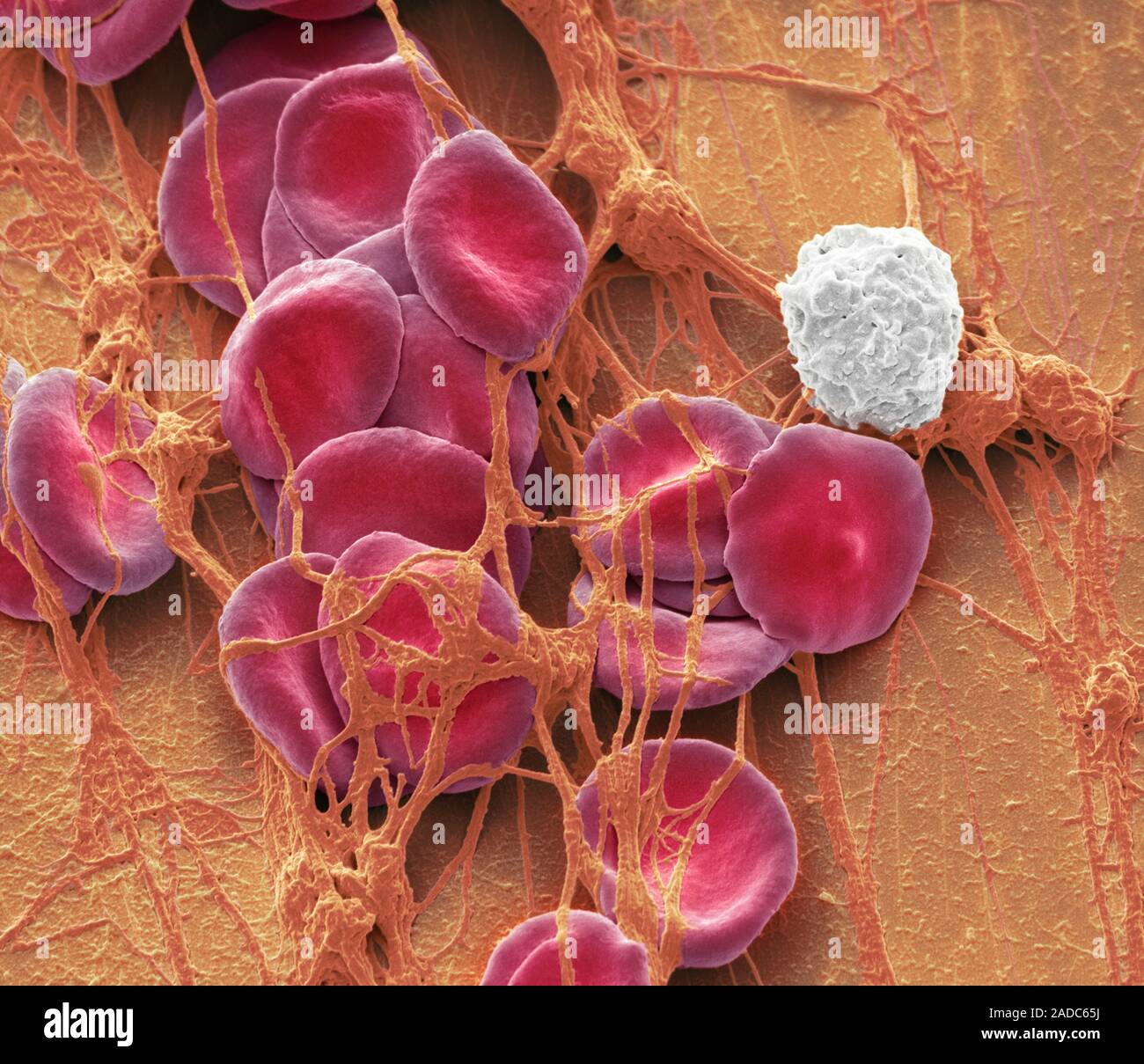 Human blood cells, Coloured scanning electron micrograph (SEM) of a ...