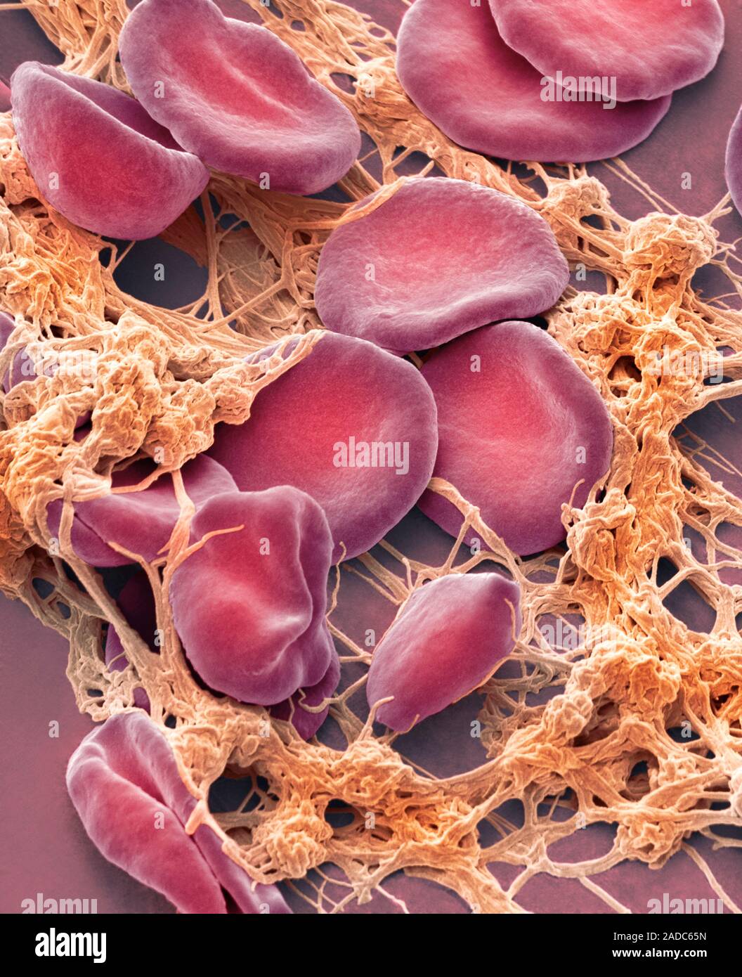 Red blood cells and platelets. Coloured scanning electon micrograph ...