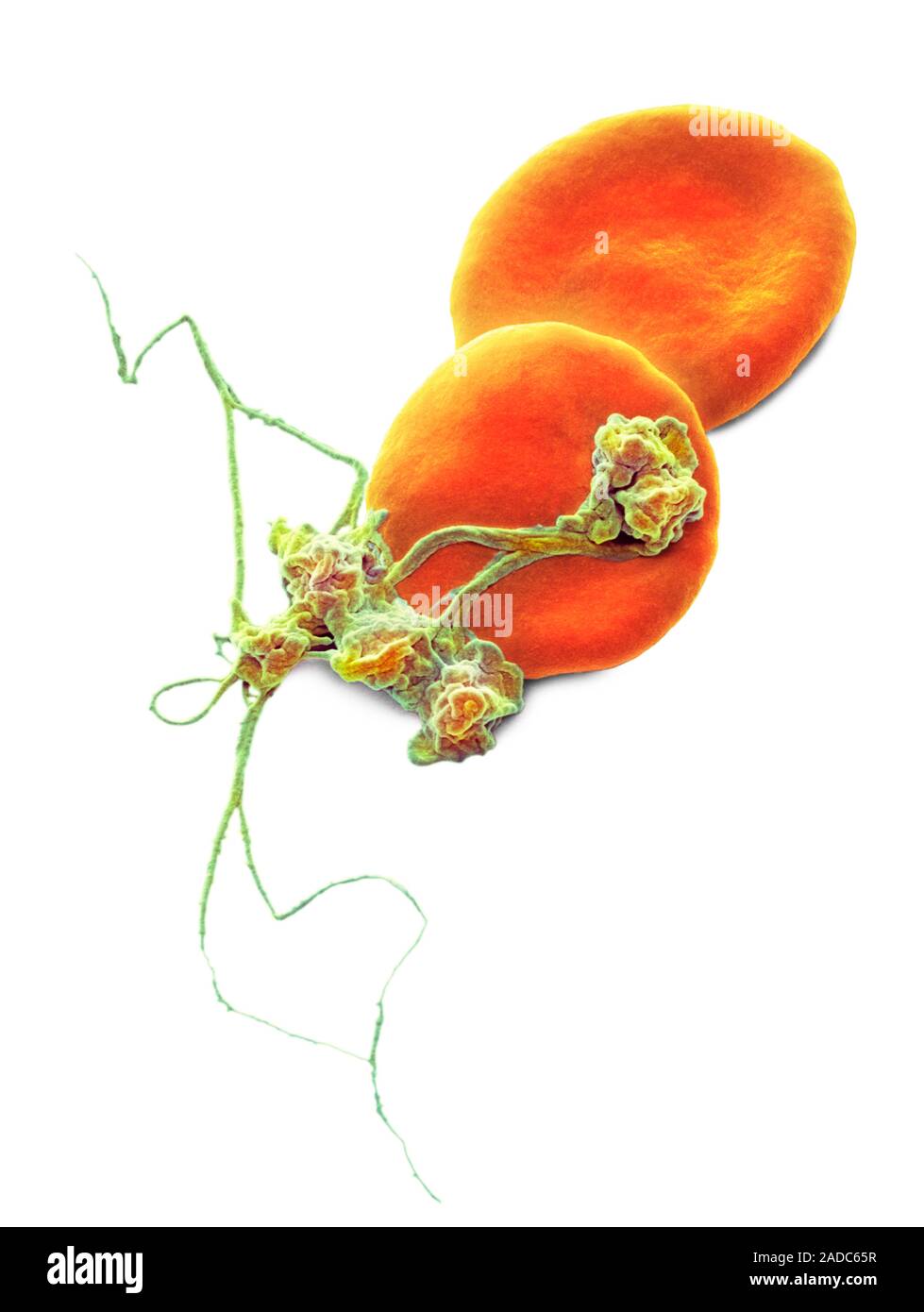 Red blood cells and platelets. Coloured scanning electon micrograph ...