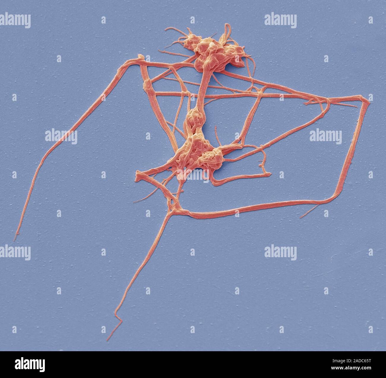Activated platelets. Coloured scanning electron micrograph (SEM) of ...