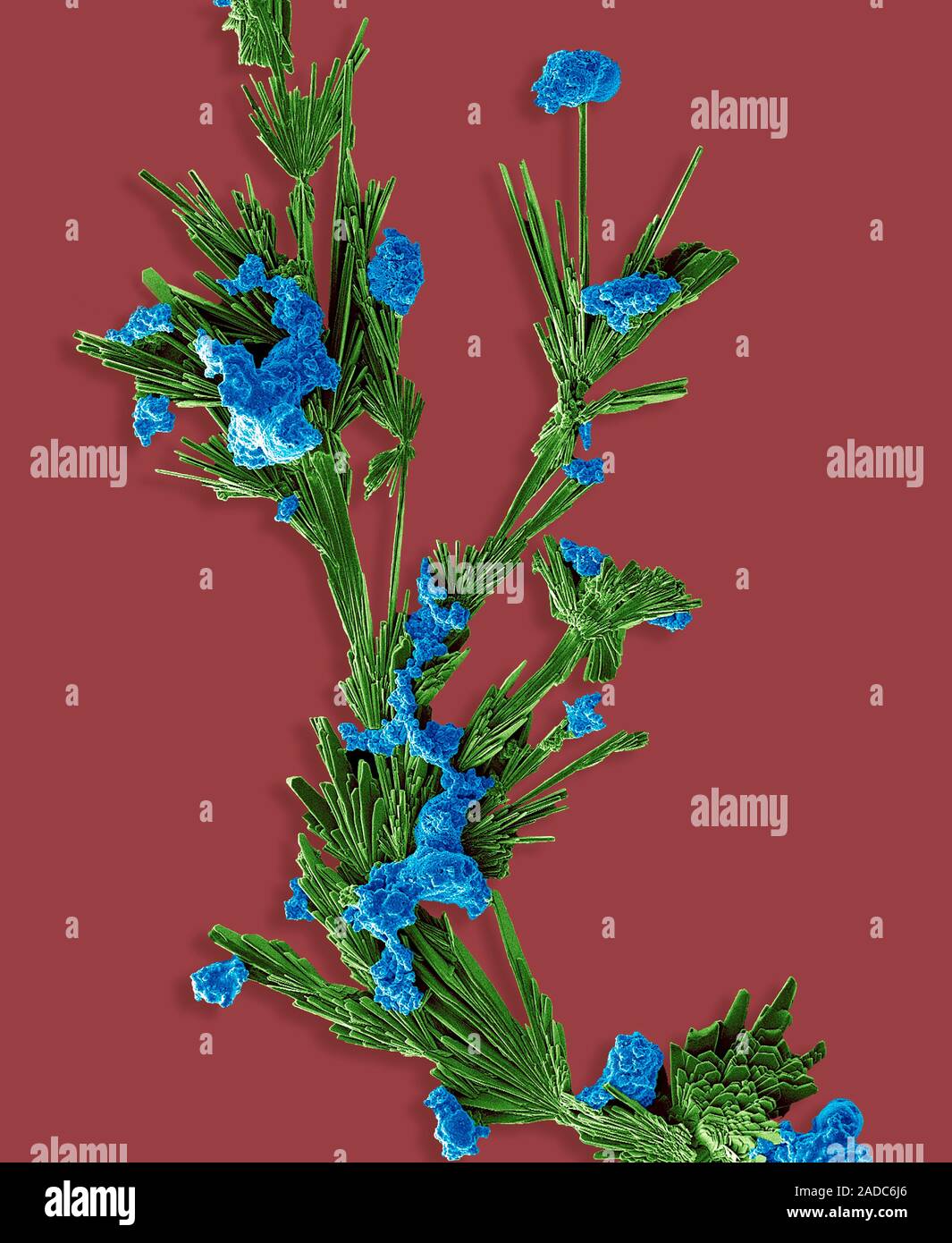 Coloured scanning electron micrograph (SEM) of calcium phosphate ...