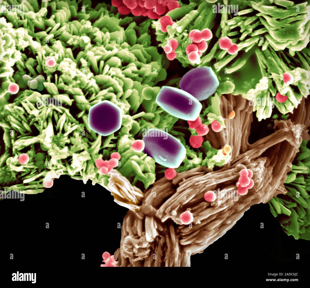 Coloured scanning electron micrograph (SEM) of calcium phosphate ...