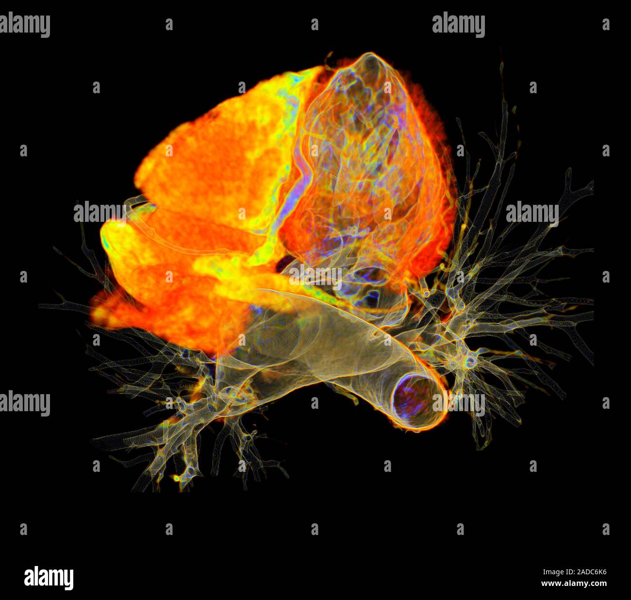 Human heart. Digitally enhanced 3D computed tomography (CT) scan of a ...