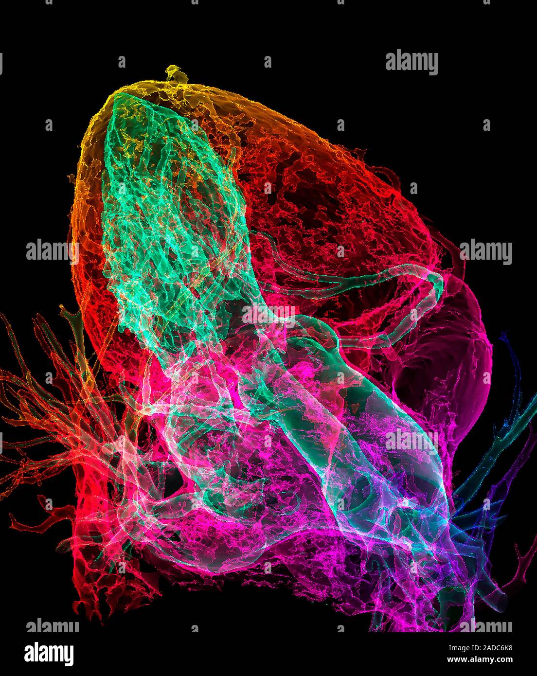 Human heart. Digitally enhanced 3D computed tomography (CT) scan of a ...