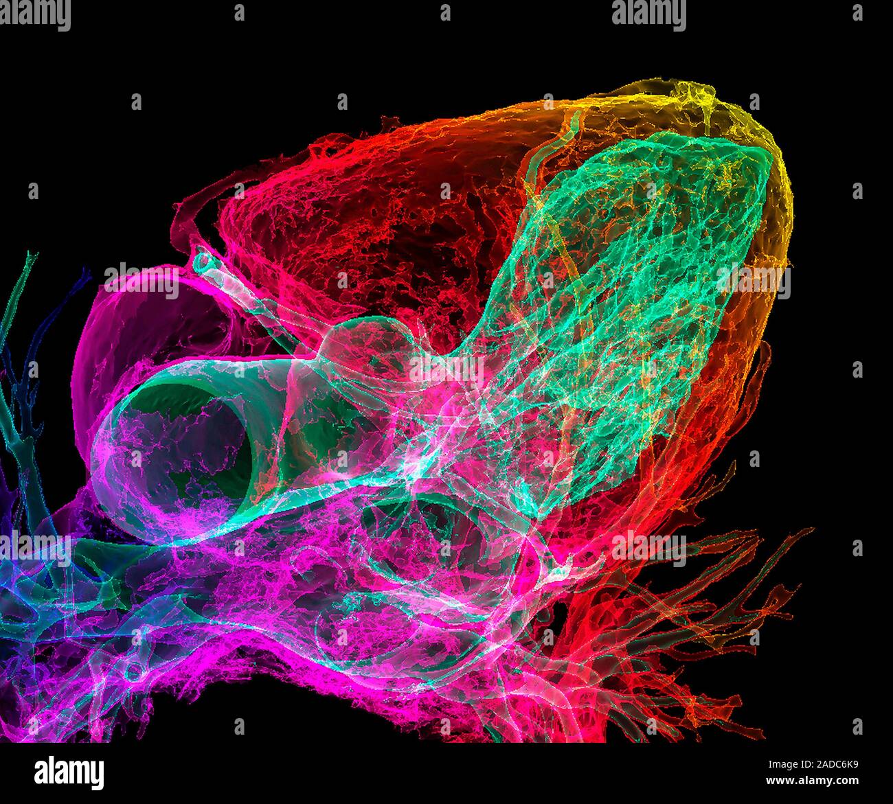 Human heart. Digitally enhanced 3D computed tomography (CT) scan of a ...