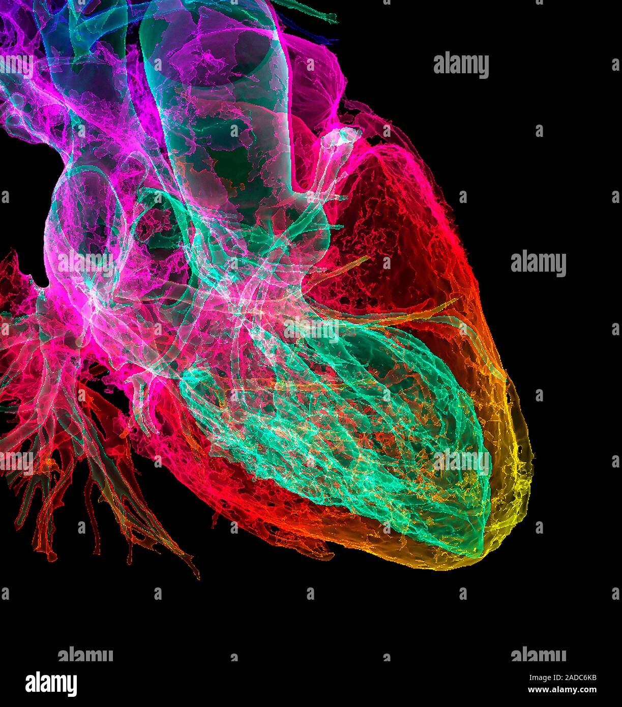 Human heart. Digitally enhanced 3D computed tomography (CT) scan of a ...