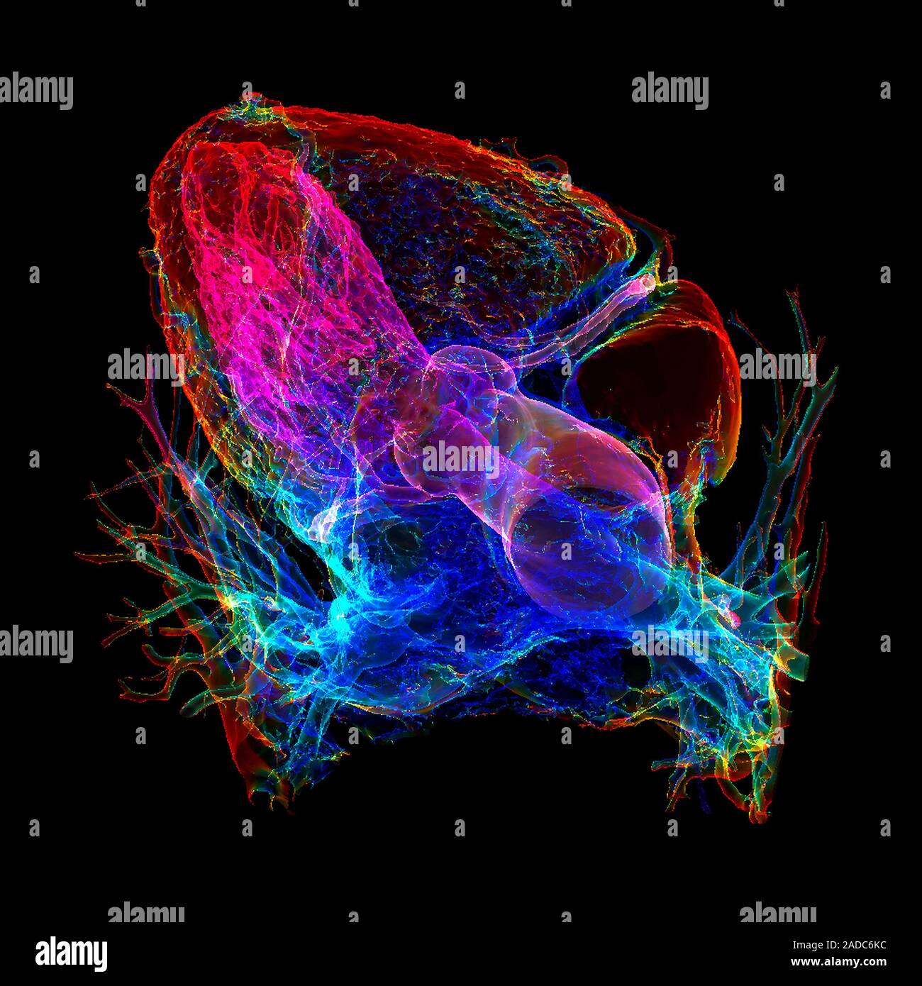 Human heart. Digitally enhanced 3D computed tomography (CT) scan of a ...