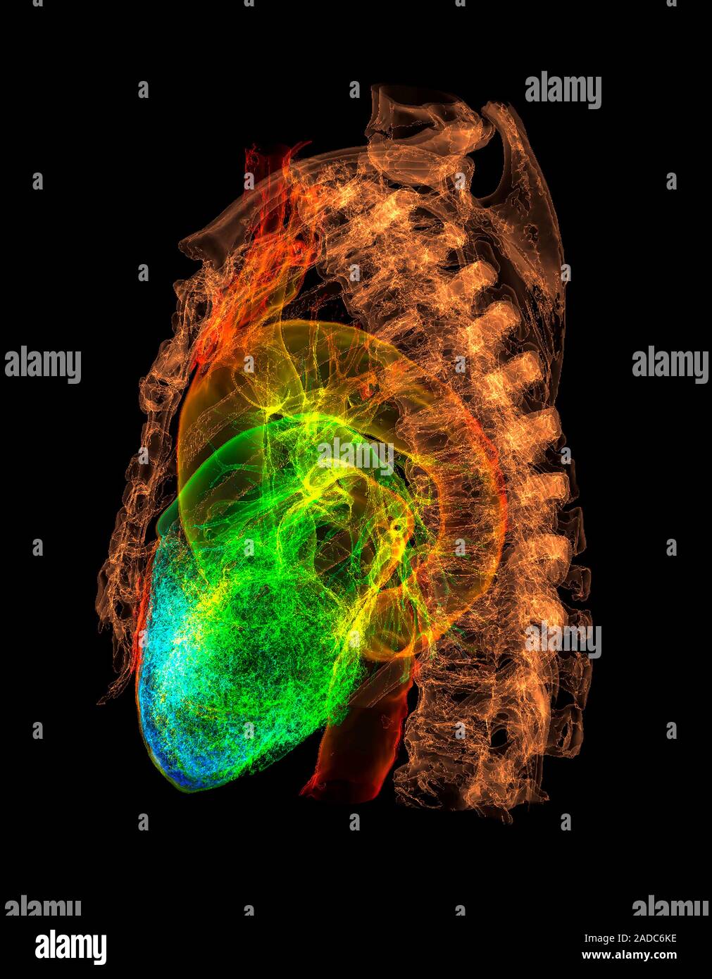 Human heart and spine. Digitally enhanced 3D computed tomography (CT ...