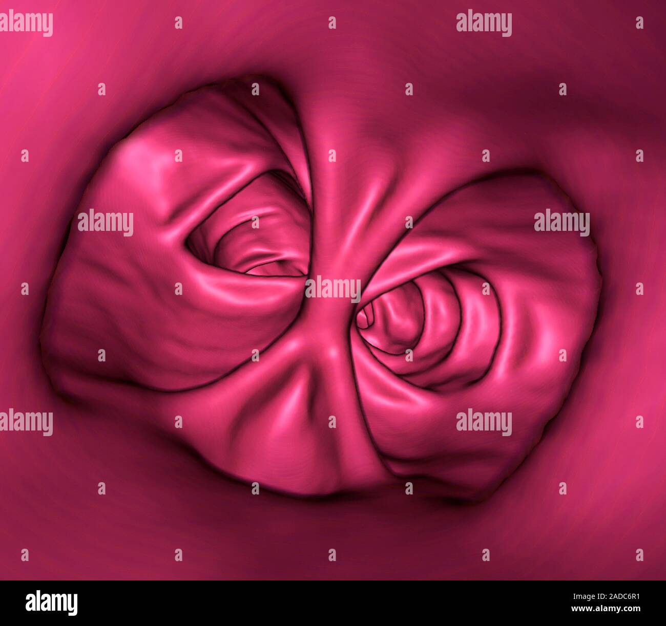 Colonoscopy view. Digitally enhanced 3D computed tomography (CT) scan ...