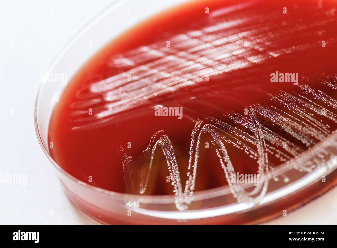 Streptococcus bacterial culture and inhibition. Close-up of a petri ...