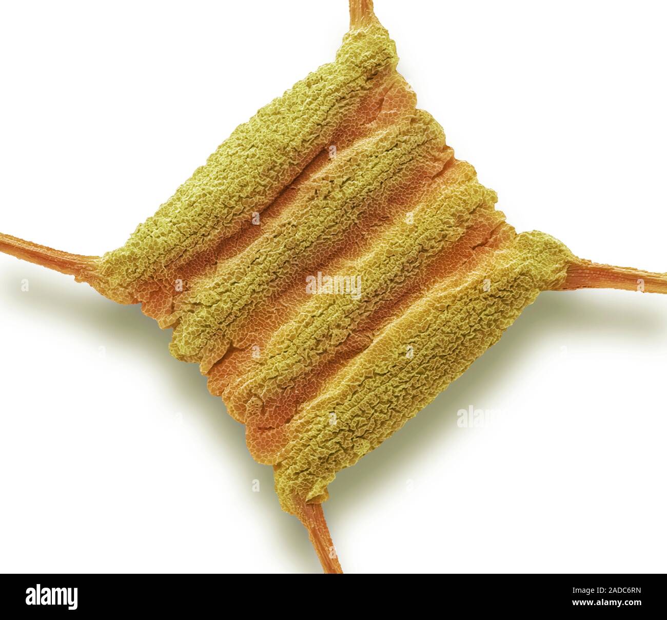 Scenedesmus quadricauda. Coloured scanning electron micrograph (SEM) of ...
