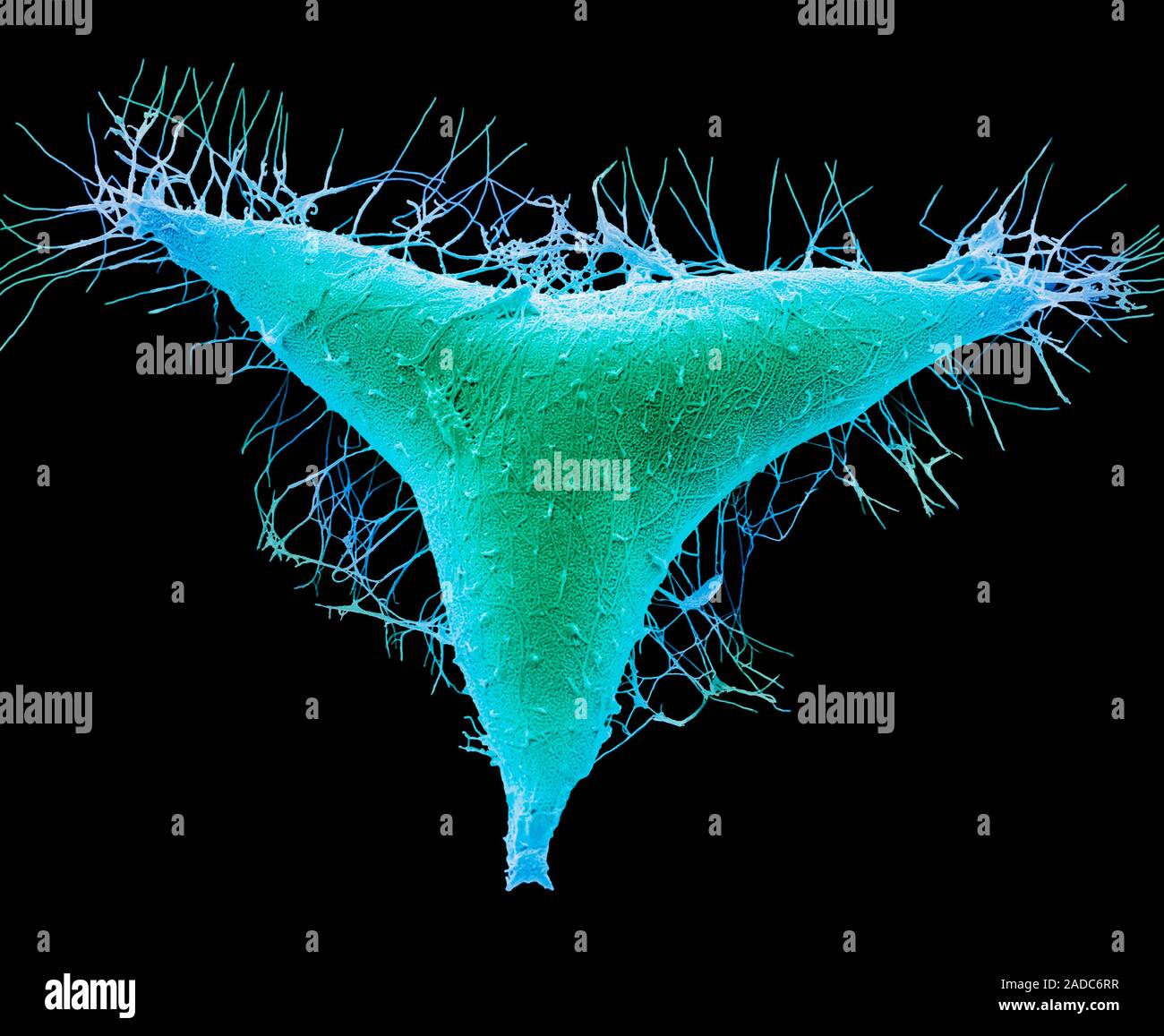Alga. Scanning electron micrograph of an unidentified alga from a lake ...