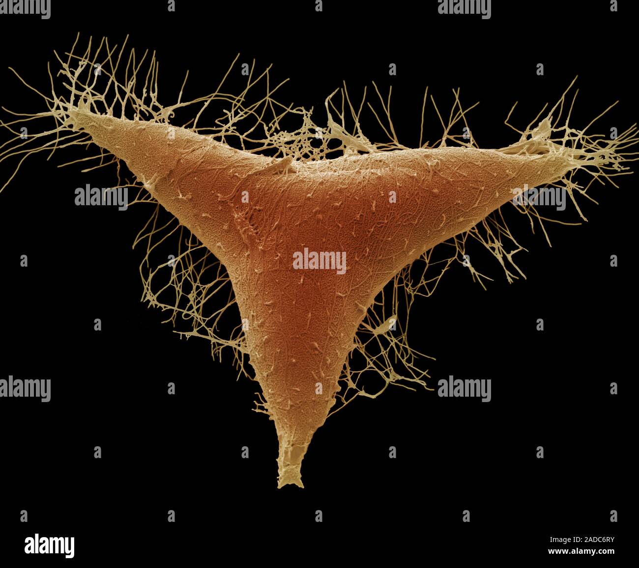 Alga. Scanning electron micrograph of an unidentified alga from a lake ...