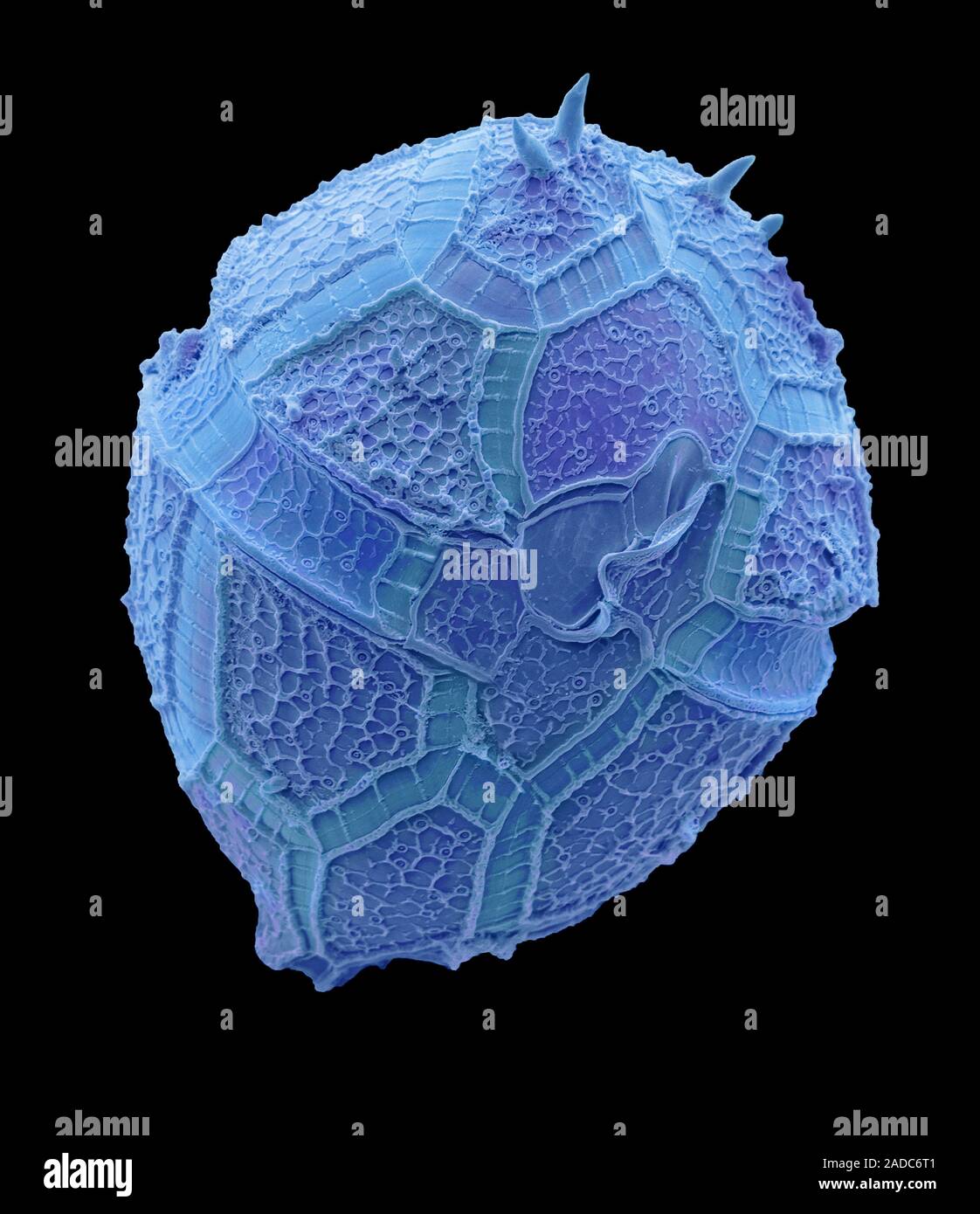 Peridinium dinoflagellate protozoan. Coloured scanning electron ...