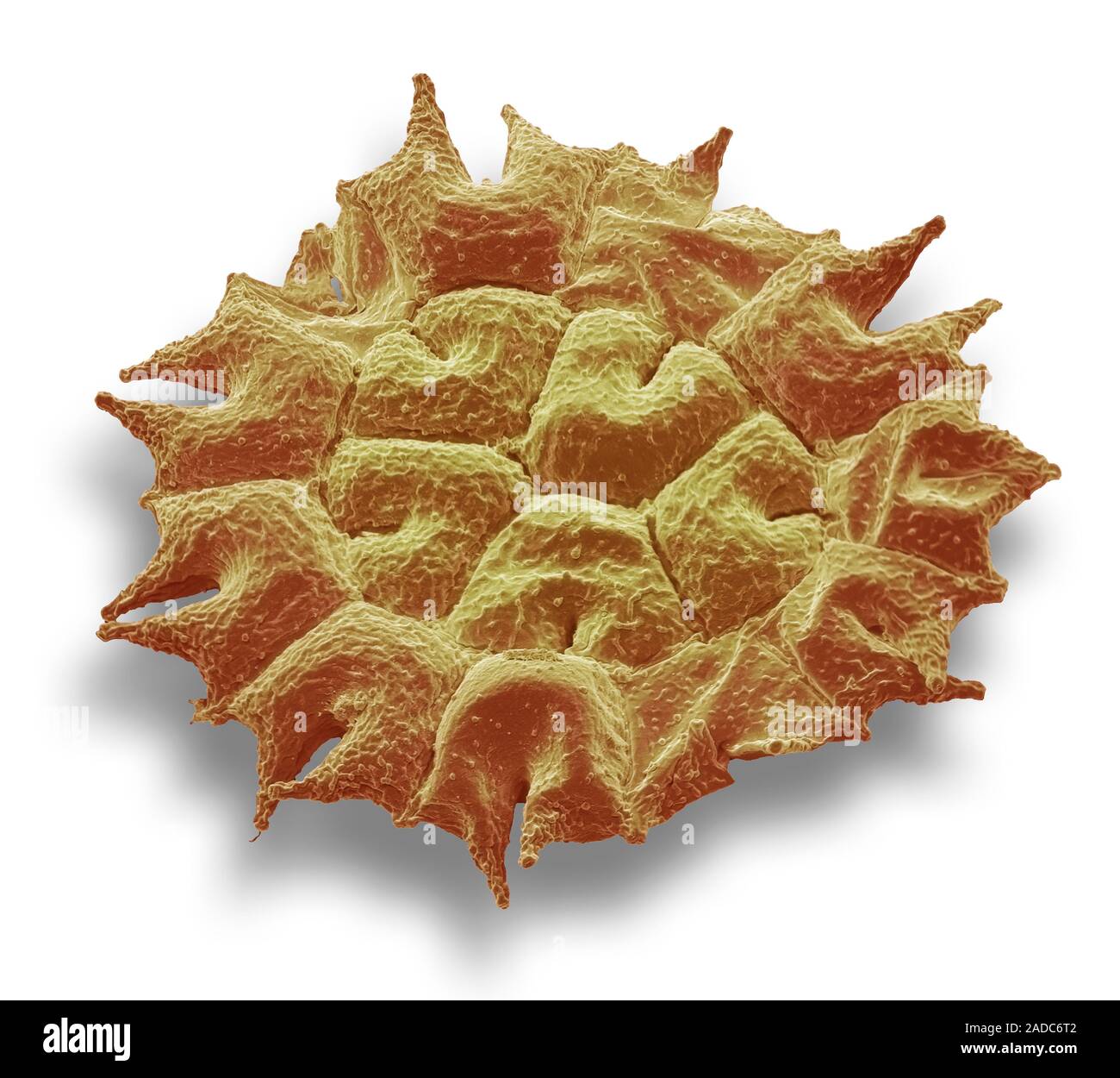 Pediastrum alga. Coloured scanning electron micrograph (SEM) of the ...