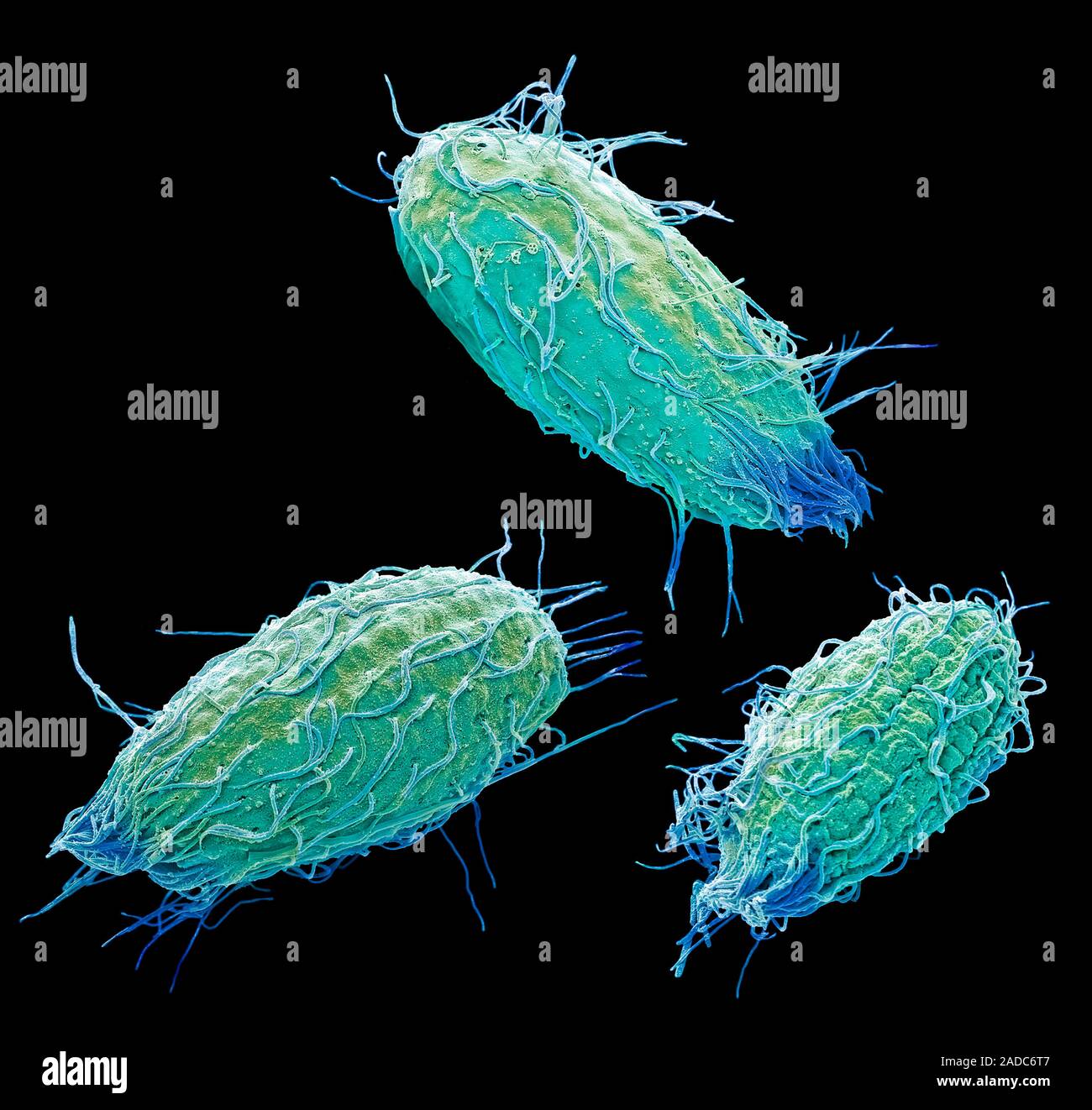 Colpidium ciliate protozoa. Coloured scanning electron micrograph (SEM ...