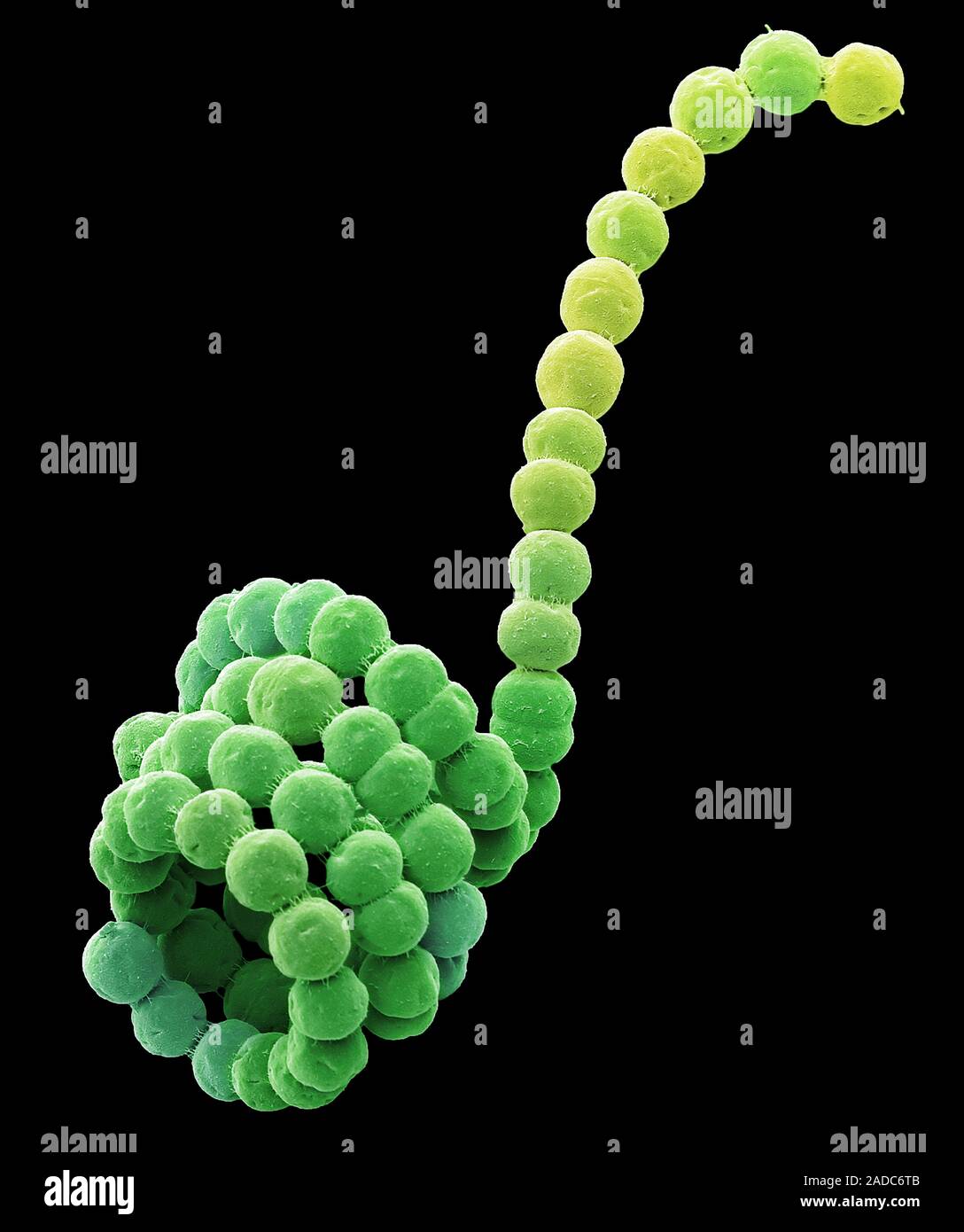 Anabaena algae. Coloured scanning electron micrograph (SEM) of Anabaena ...