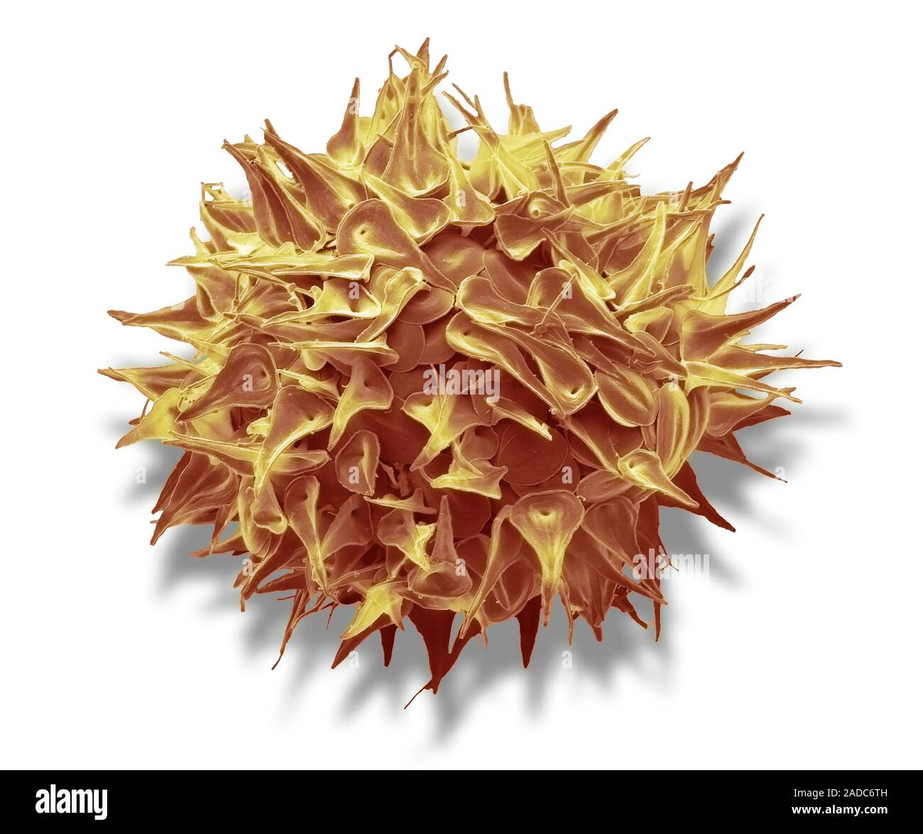 Pterocystis heliozoan. Coloured scanning electron micrograph (SEM) of ...