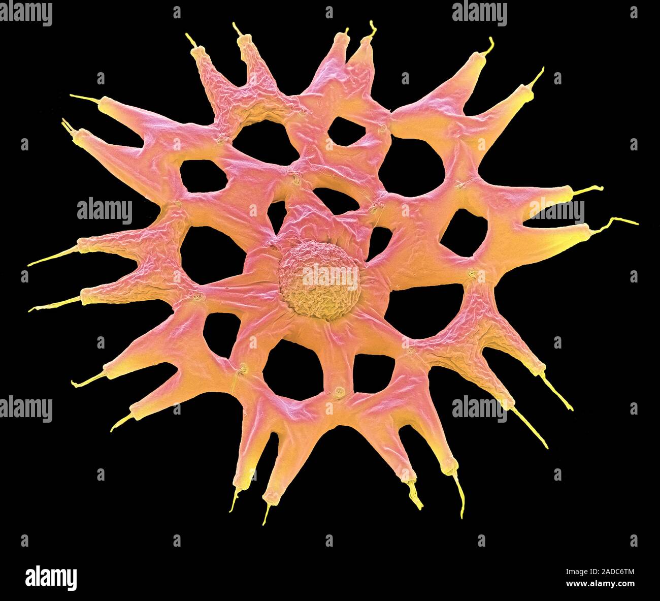 Pediastrum alga. Coloured scanning electron micrograph (SEM) of the ...