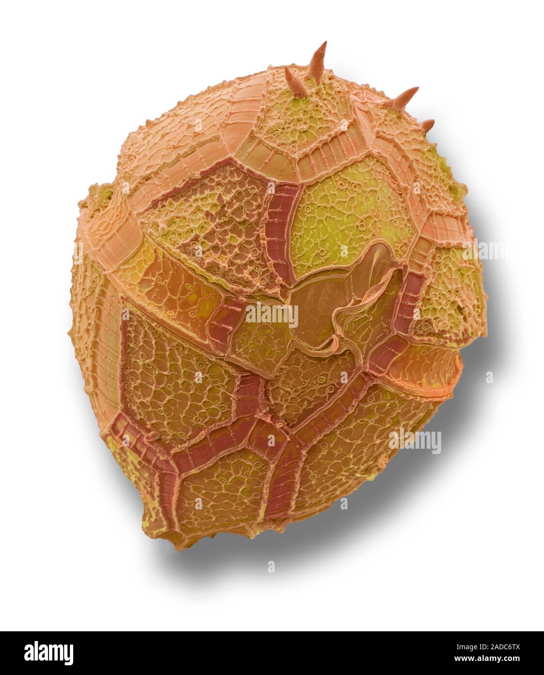 Peridinium dinoflagellate protozoan. Coloured scanning electron ...