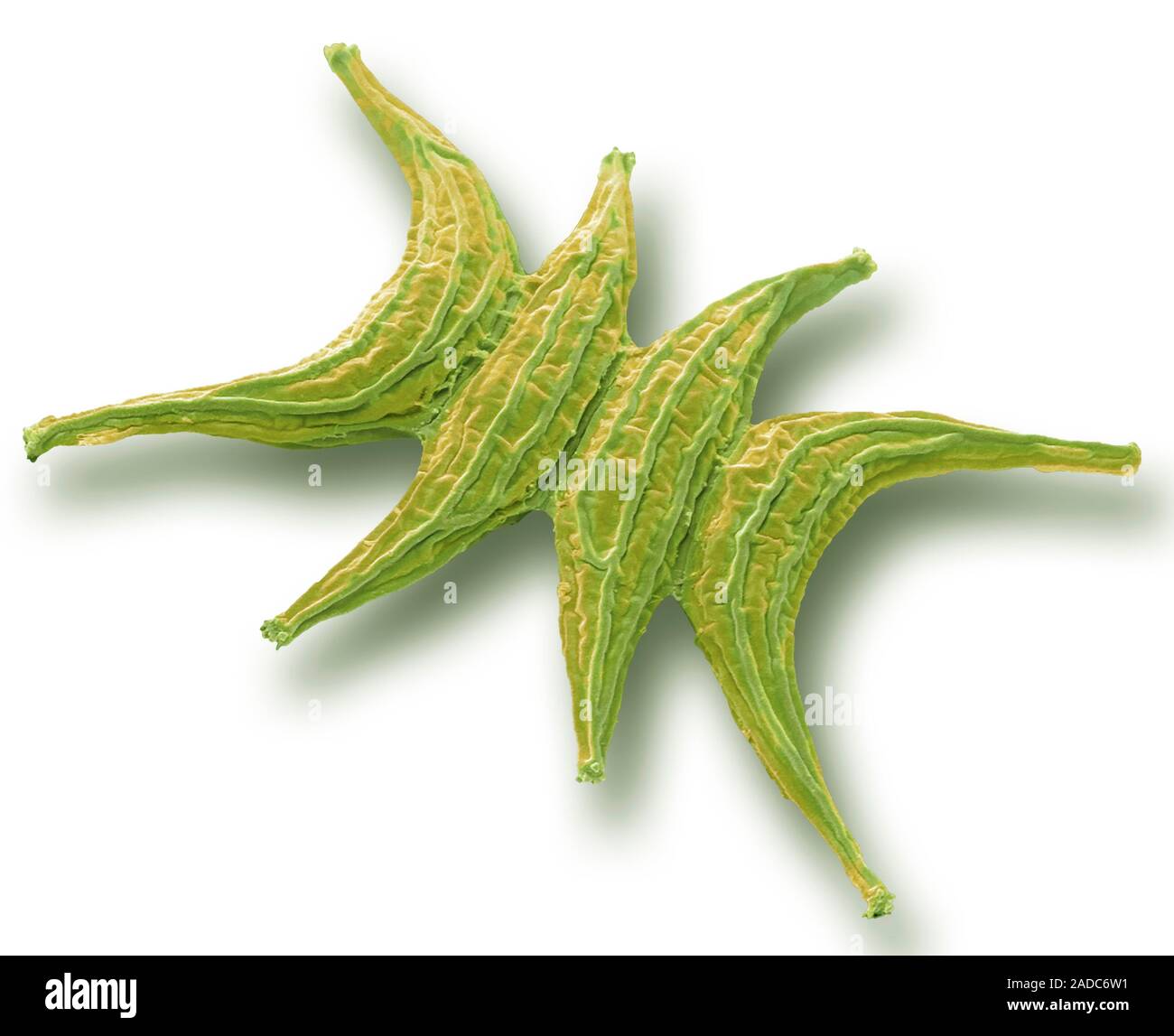Scenedesmus acutus. Coloured scanning electron micrograph (SEM) of ...