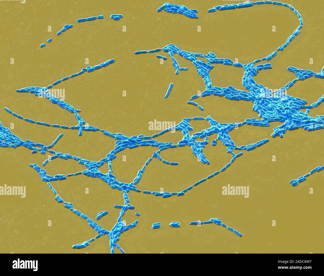 Bacillus cereus. Coloured scanning electron micrograph (SEM) of ...