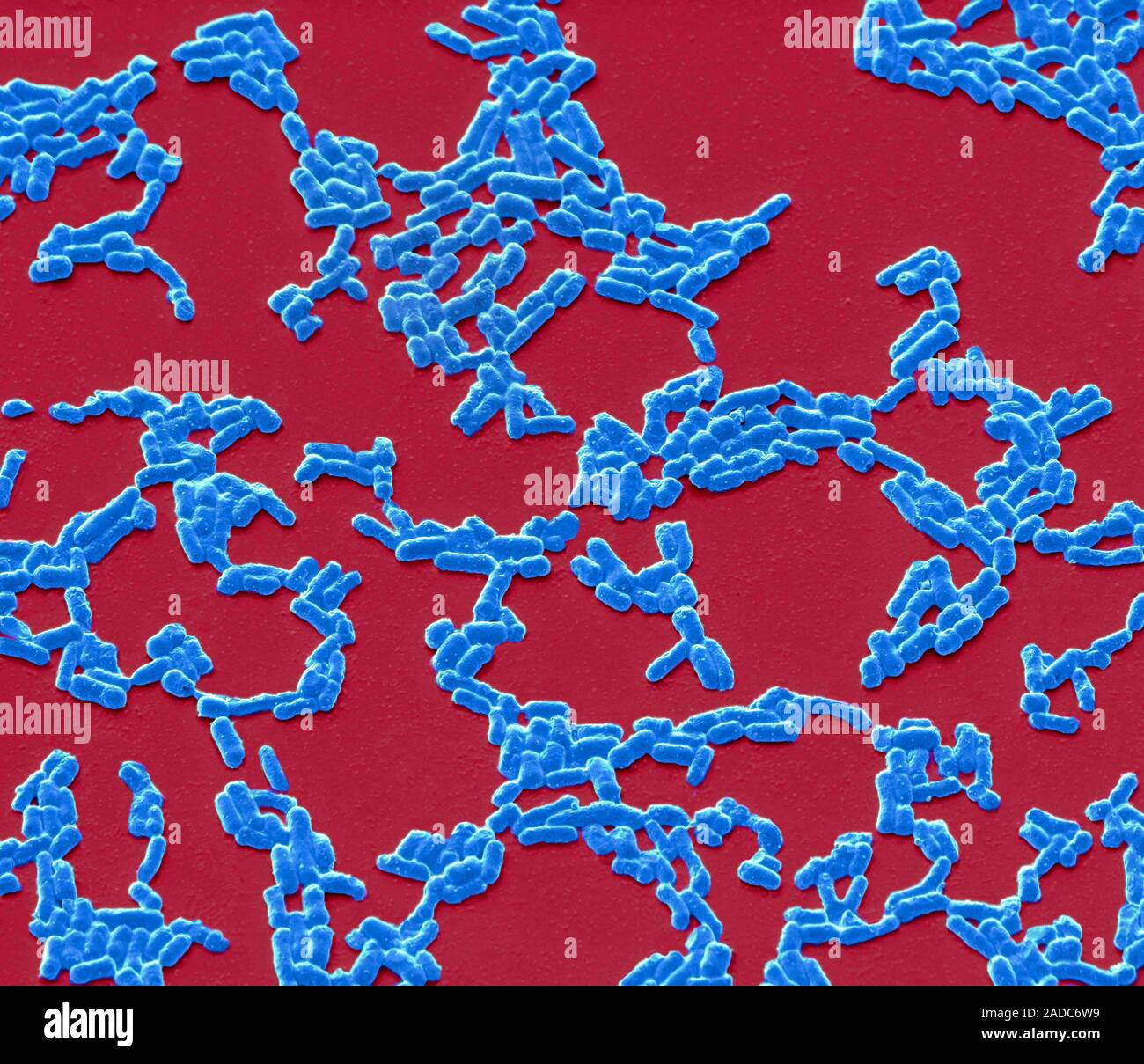 Salmonella typhi. Coloured scanning electron micrograph (SEM) of ...