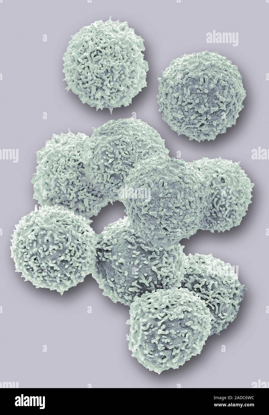 Lymphocyte white blood cells. Coloured scanning electron micrograph ...
