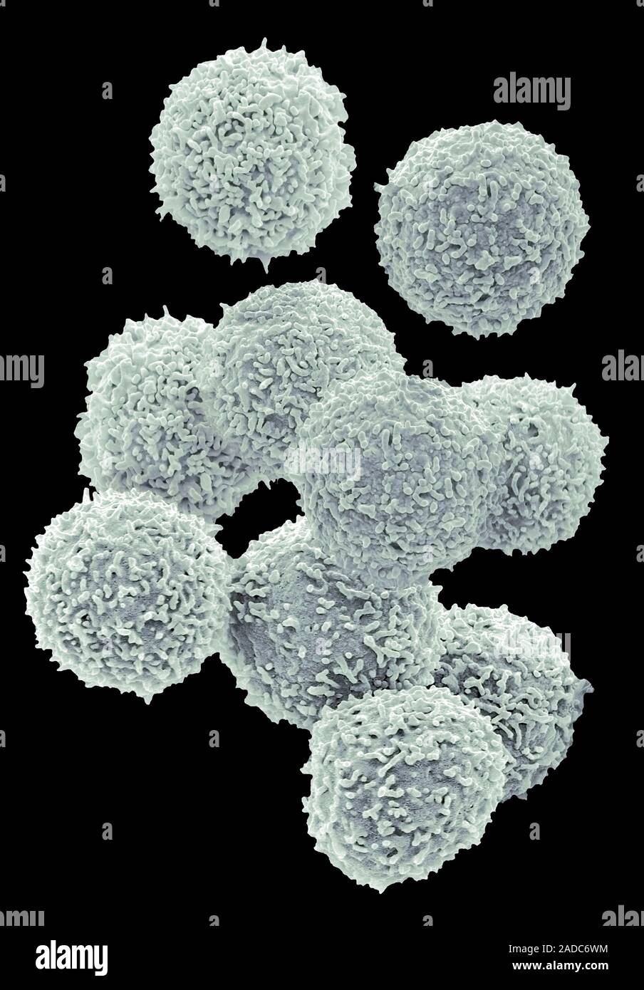 Lymphocyte white blood cells. Coloured scanning electron micrograph ...