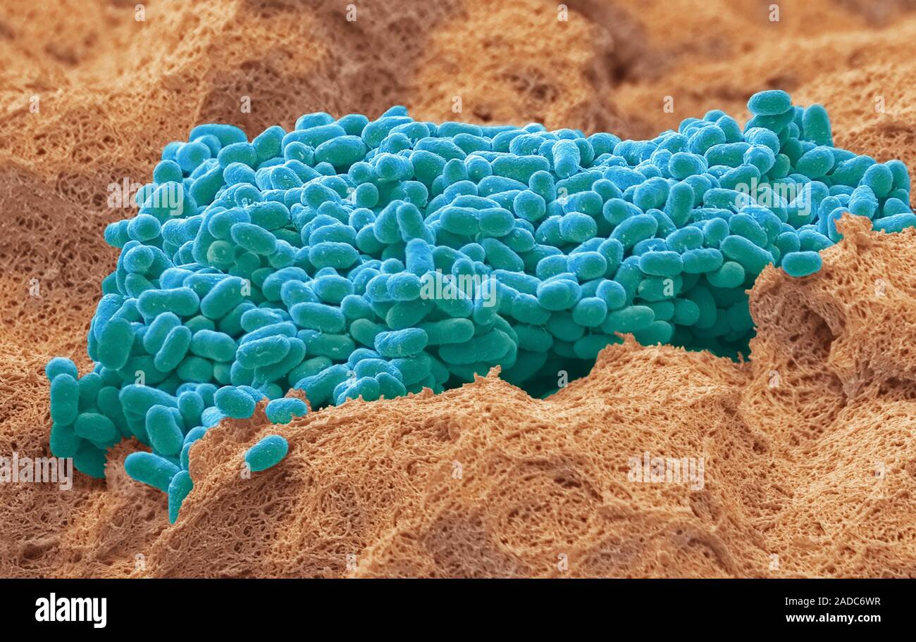 Microbiome. Coloured scanning electron micrograph (SEM) of bacteria ...